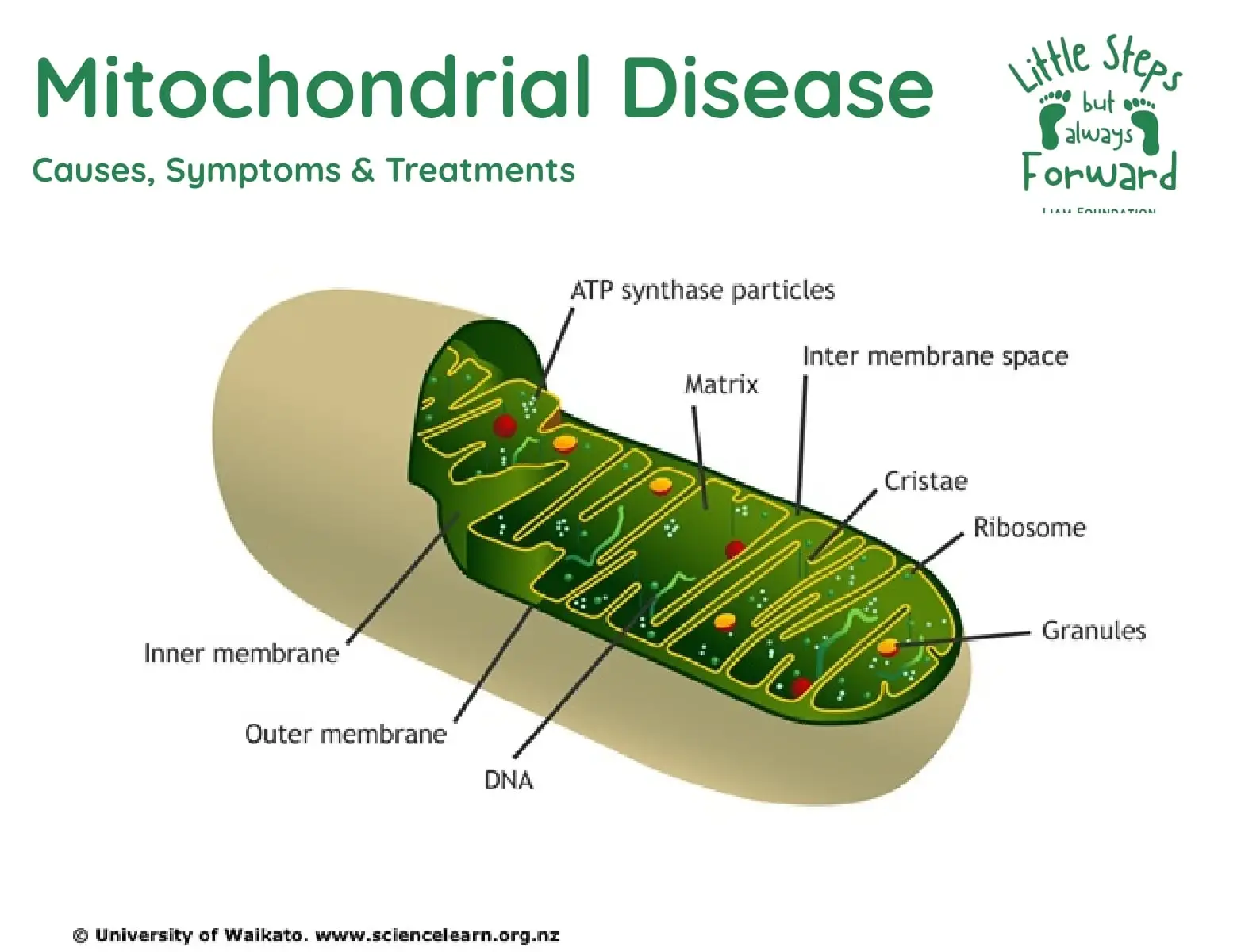 Mitochondrial Disease - Cause, Symptoms, Treatments